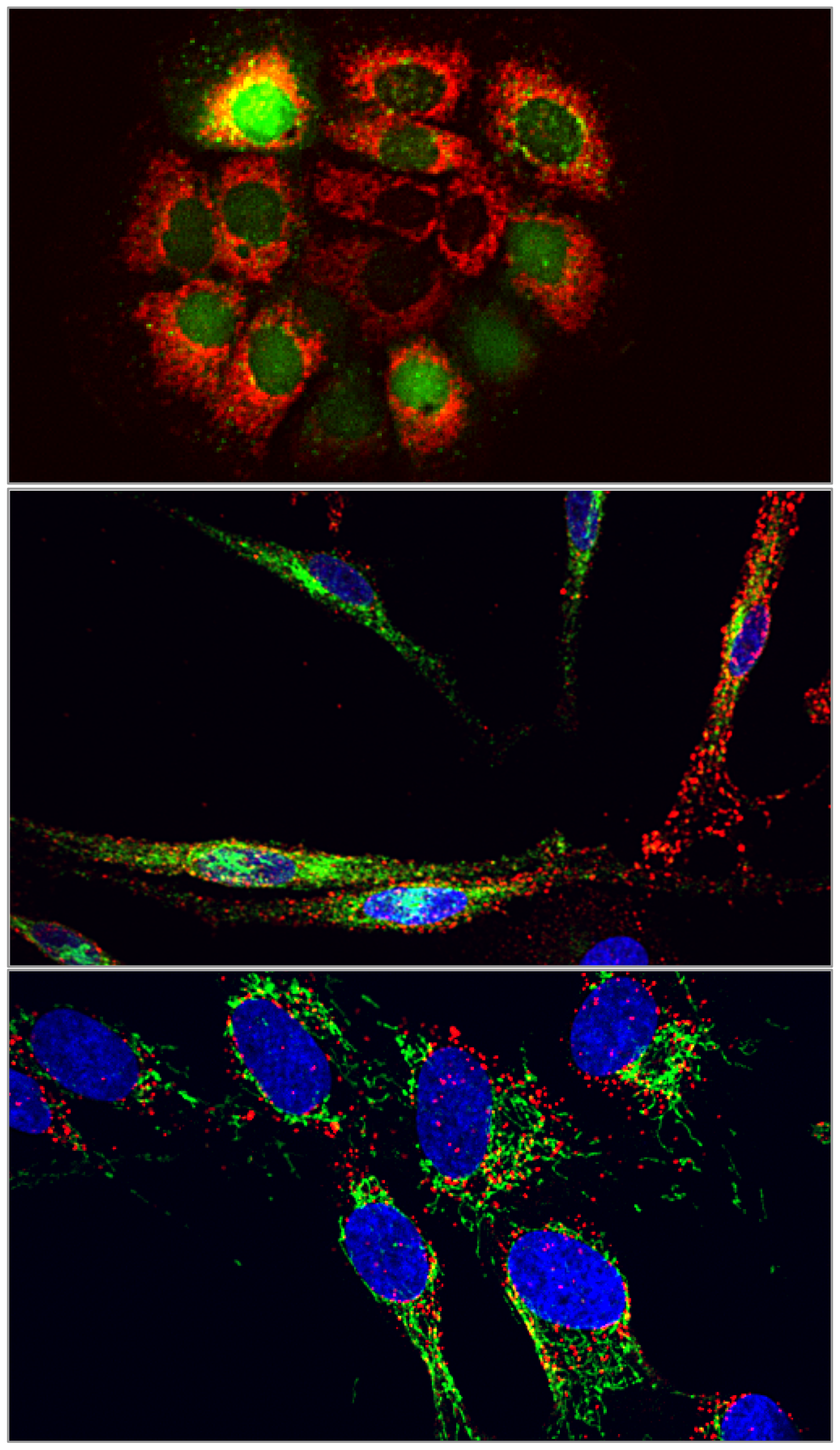 Cavinato Lab – Laboratory of Cellular Senescence and Skin Biology