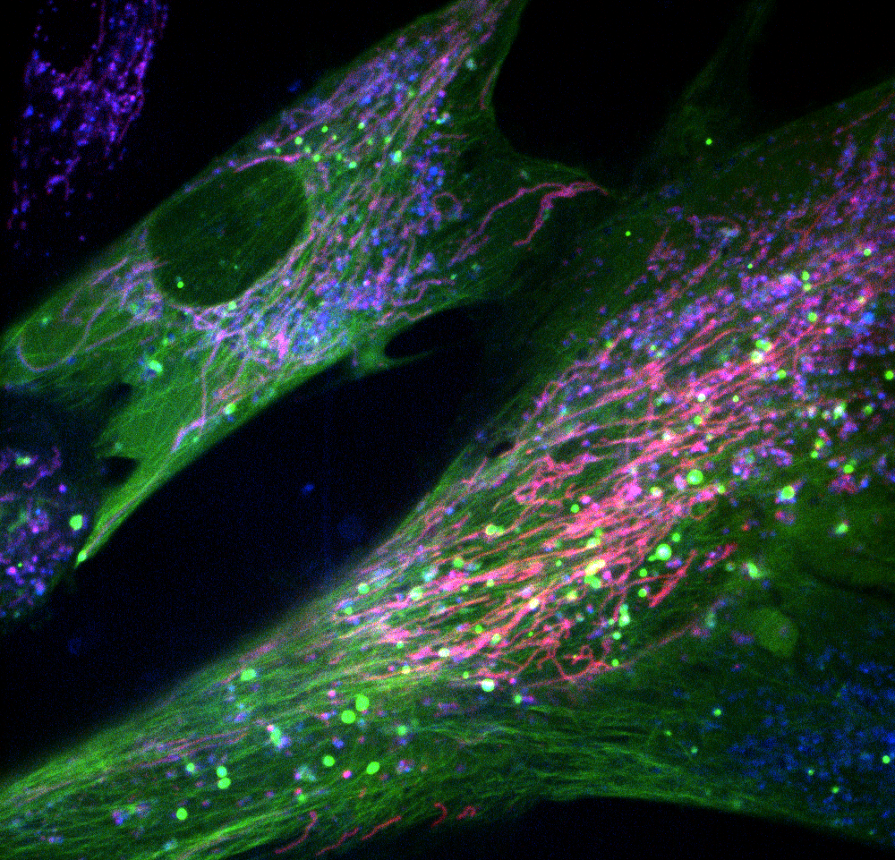 Cavinato Lab – Laboratory of Cellular Senescence and Skin Biology